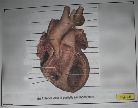 Anterior View Of Partially Sectioned Heart Diagram Quizlet
