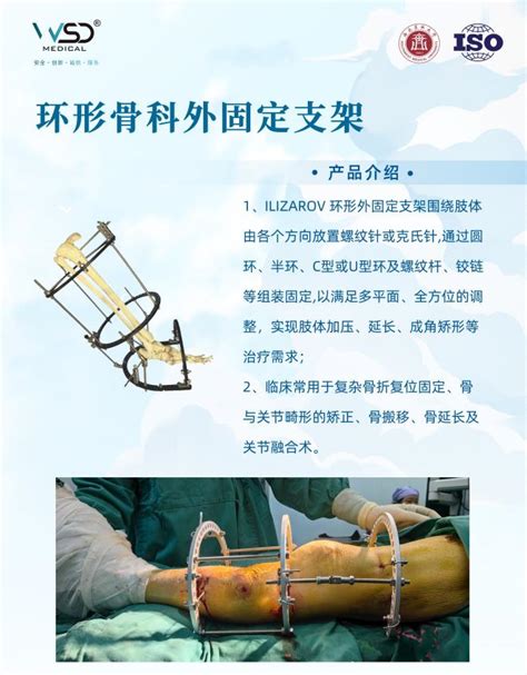 彩页 环形骨科外固定支架 四川维思达医疗器械有限公司