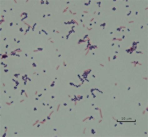Gram Stain E Coli