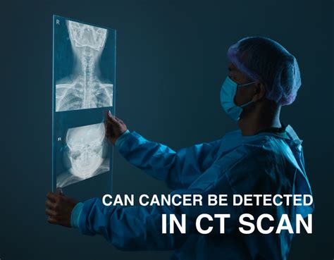 Carcinoma Vs Sarcoma Whats The Difference