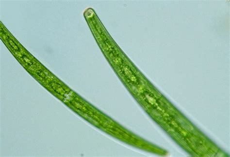 Protist Images Closterium Intermedium
