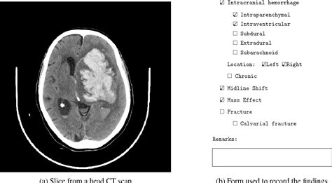 Development And Validation Of Deep Learning Algorithms For Detection Of Critical Findings In