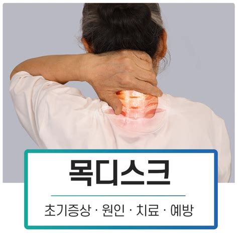 부산서면병원 목디스크 초기증상 원인 치료 예방 방법 네이버 블로그