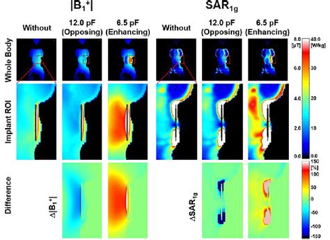 Numerical Simulation Results Of B 1 Left Three Columns And Sar