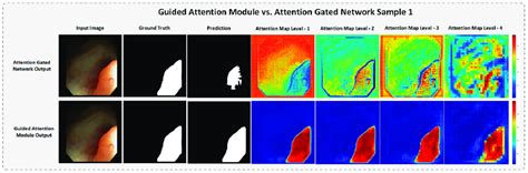 the attention visualization comparison attention gated network vs