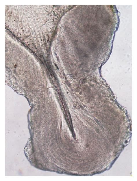 Incremental Lines Of Enamel Photomicrograph Ground Section 10x