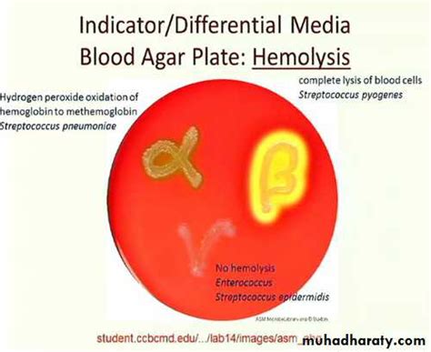 Systemic Bacteriology Pptx D Faten Muhadharaty