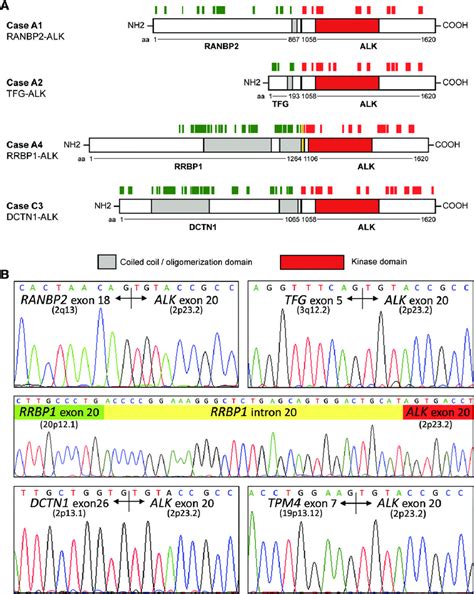 A Each Of Four Aberrant Alk Proteins Characterized By Mass Download Scientific Diagram
