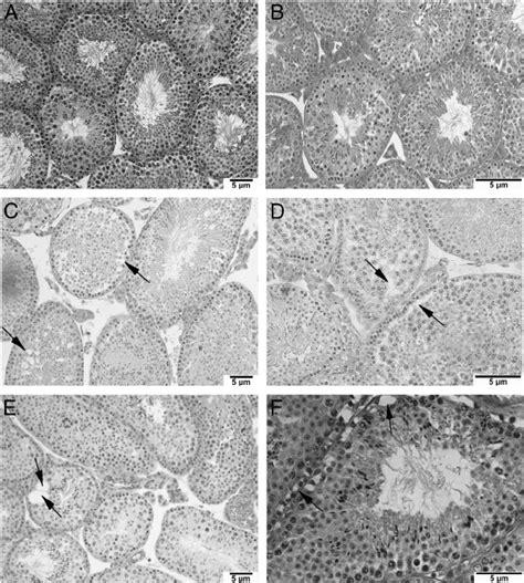 Hematoxylin Eosin Staining Of Testis Cross Sections In Black And White