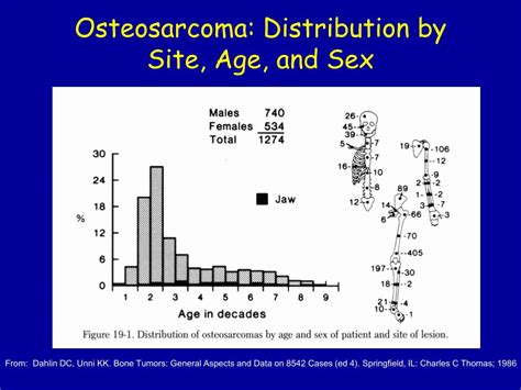 Ppt Sarcomas Powerpoint Presentation Free Download Id 250129