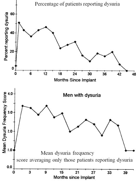 Dysuria After A Seed Implant