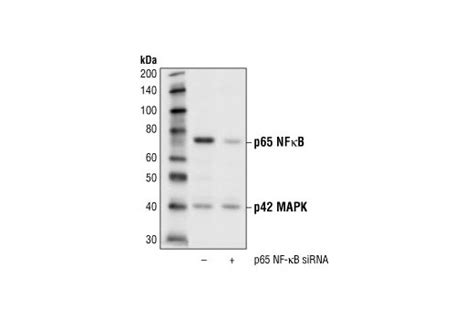 Nf B P Antibody Cell Signaling Technology
