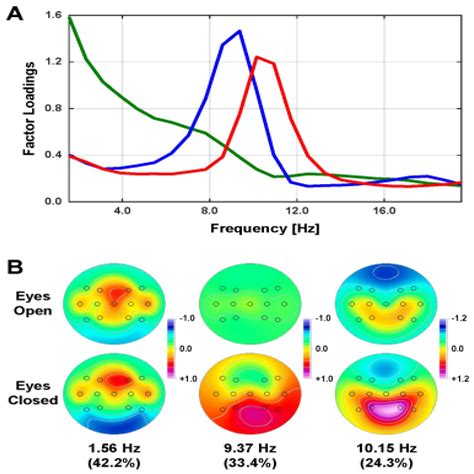 Electronics Free Full Text Deep Learning Techniques For Pattern Recognition In Eeg Audio