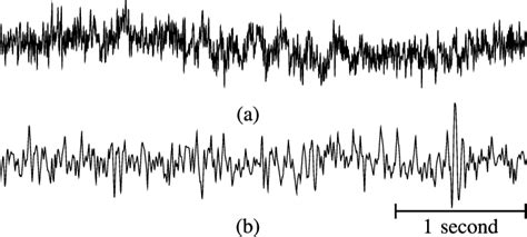 Figure 1 From Improving Eeg Muscle Artifact Removal With An Emg Array Semantic Scholar
