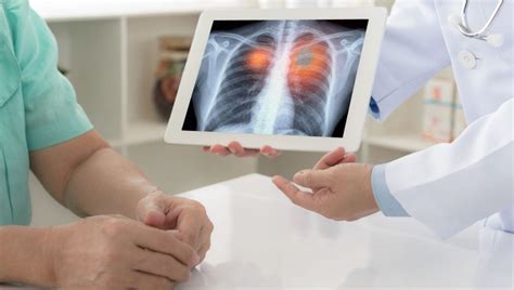 Janssen Celebrates An Early Win For Nipocalimab In Hdfn Clinical