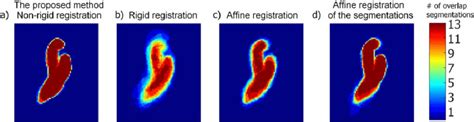 The Mip Of The Overlapping Segmentations Which Were Deformed Using A Download Scientific