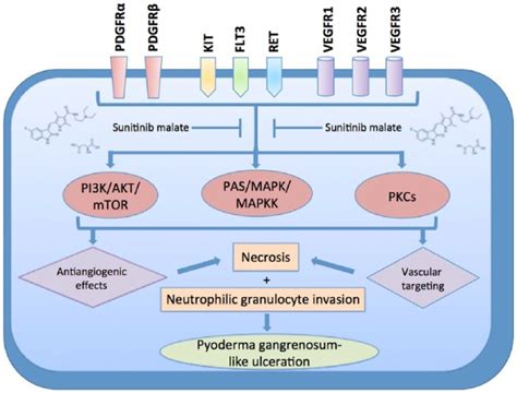 Pyoderma Gangrenosumlike Ulceration Of The Lower Extremity Secondary