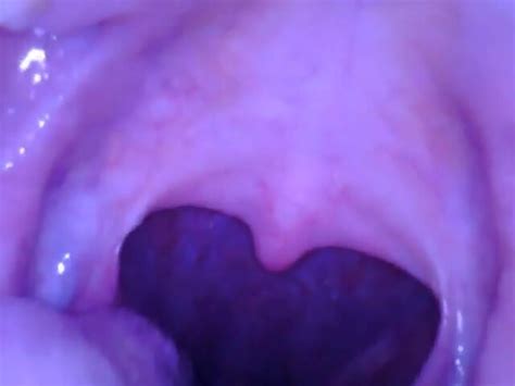 Teef Lady Endoscope Thisvid Com