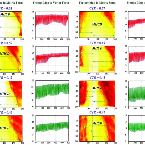 Feature Maps For Normal Condition Ctr ≤ 050 And Cardiomegaly Ctr Download Scientific