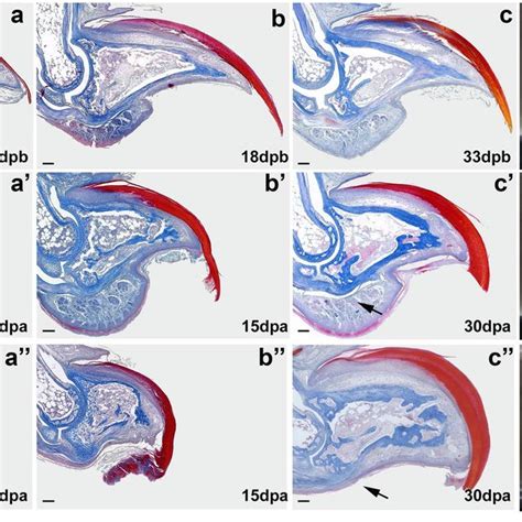 Normal And Amputated Mouse Digit Tips Showing The Completeness Of