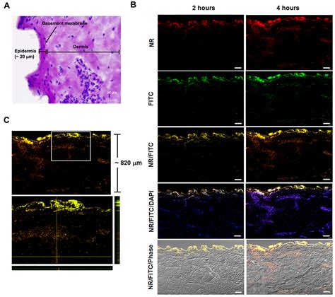Potentiality Of Melittin Loaded Niosomal Vesicles Against Vancomycin I Ijn