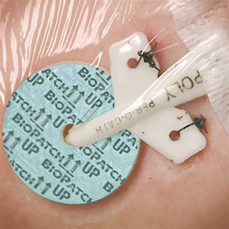 Biopatch™ Chg Reduce The Risk Of Infections Ethicon