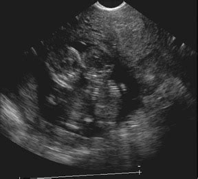 How Soon After Intercourse Can You Take A Pregnancy Test