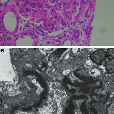 The Alternative Pathway Of The Complement Cascade Is Systematically