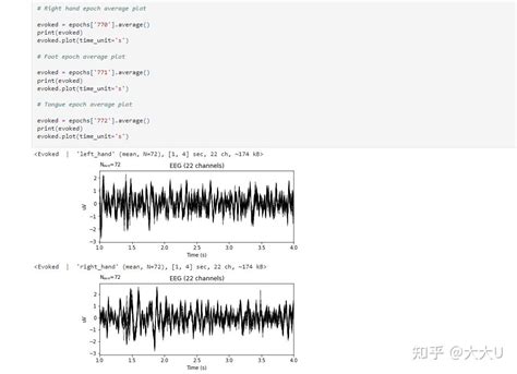 带你读脑电信号EEG源码1 ANN 知乎