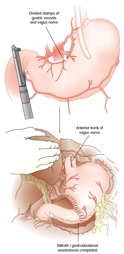 Surgicalcore Tablefigure