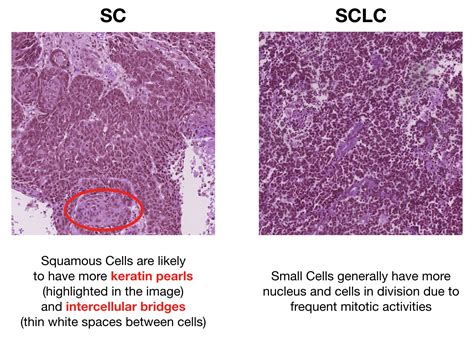 Histology Of The Lung Youtube