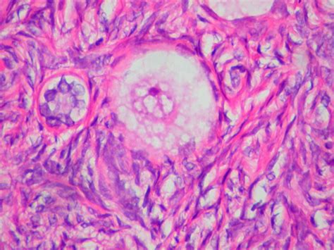 How To Determine And Track Ovulation HubPages