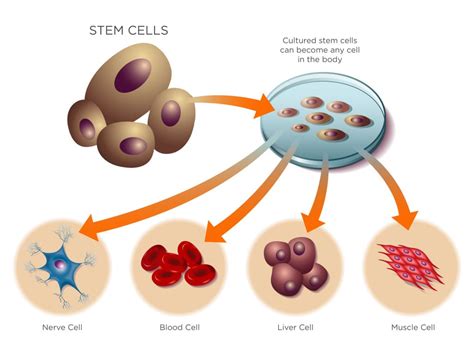 Umm Stem Cell Transplant Leukemia Survivor Runs Half Marathon To Raise