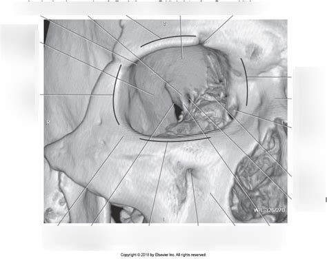 3d Ct Of Bony Orbit Diagram Quizlet