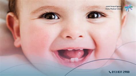 اسباب تأخر ظهور الأسنان عند الرضع والاطفال عيادات الدوحة