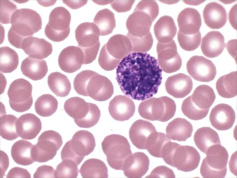 basophils