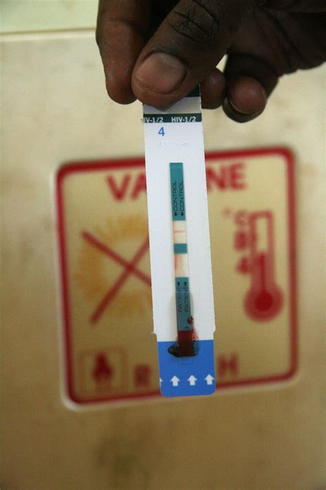 Hiv Test Results