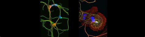 Cytoskeleton Of Neuron Ndrian