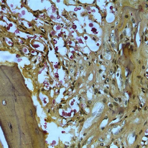 Photomicrographic Appearance Of Cryptococcus In The Ankle Synovium With Download Scientific Photomicrographic Appearance Of Cryptococcus In The Ankle Synovium With Download Scientific
