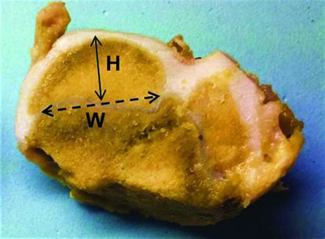 Description Of The Height And Width Of The Epiphysis And Epiphyseal Download Scientific Diagram