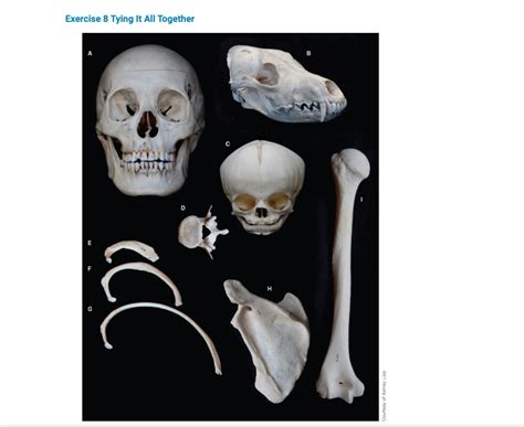 Solved Can Any Of The Skeletal Material Be Used To