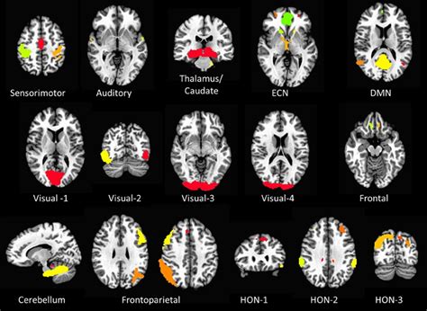 The 16 Resting State Networks And Their Corresponding Node Regions Download Scientific Diagram
