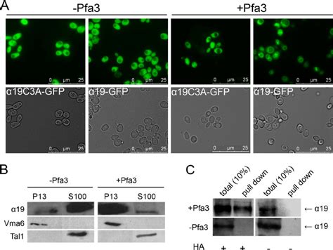 Evidence Of Palmitoylation Of ␣ 19 Giardin A Localization Of Download Scientific Diagram