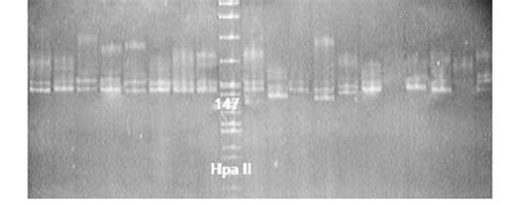 Electropherogram Of Ls254200 Locus Values For Larix Gmélinii And