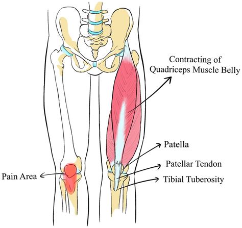 Frontiers Advancing Musculoskeletal Diagnosis And Therapy A