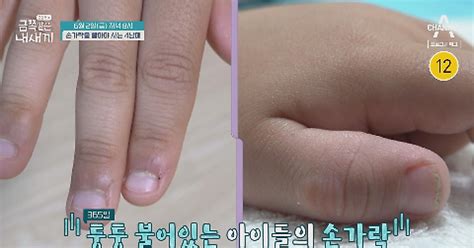 ‘금쪽같은 내새끼 손가락 빠는 4남매 오은영 “부모 언행 문제”