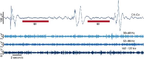 Time Domain Plot Of A Preterm Eeg Segment An Example Of Interburst Download Scientific Diagram
