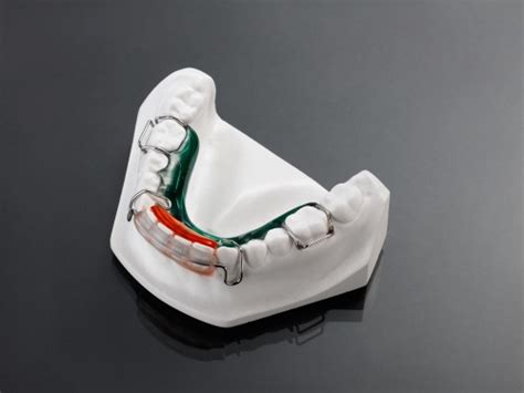 Spring Retainer ORTHODONTIC APPLIANCE