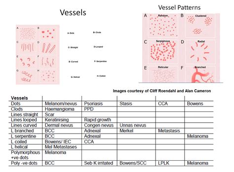 Dermoscopy Made Simple Vessels