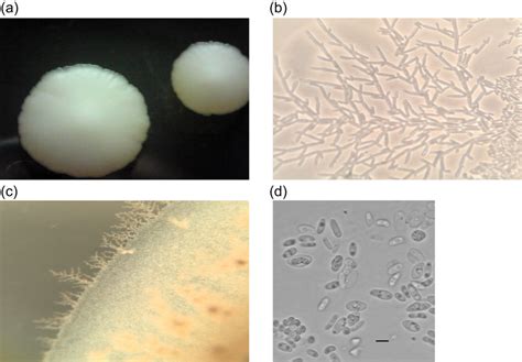 A Colony Morphology On Yeast‐peptone‐dextrose B C Pseudohyphal Download Scientific